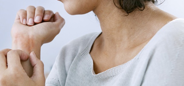 L’urticaire concerne 15 à 20% des individus